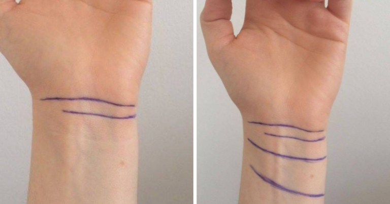 Liczba linii na nadgarstku powie wszystko o Twoim zdrowiu. Lepiej żebyś ...